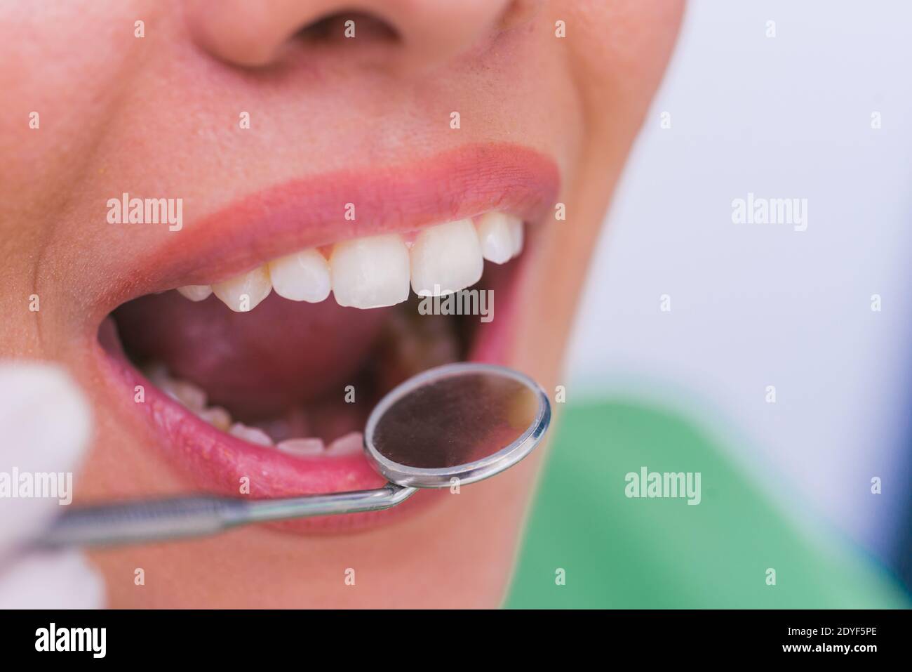 Closeup of a female patient with an open mouth during oral checkup at ...