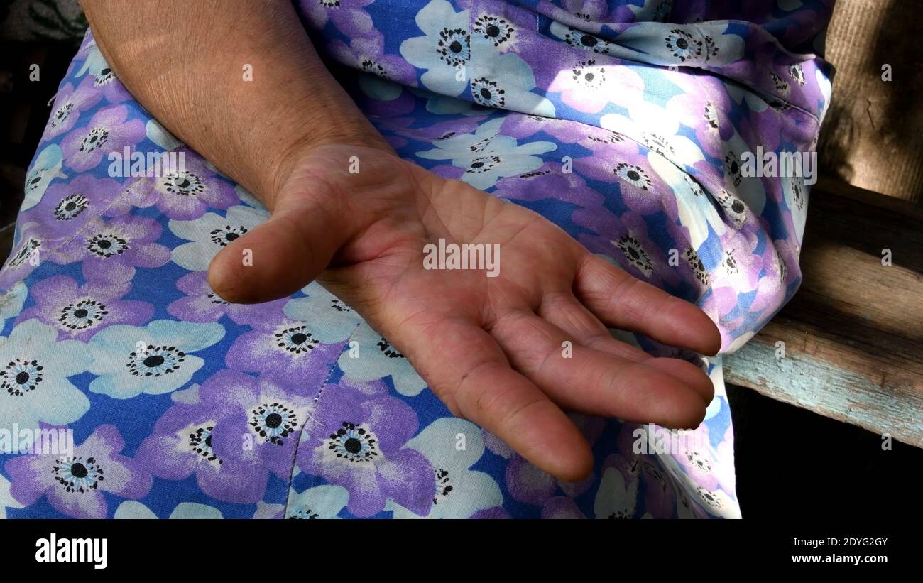 Opened palm hand of senior woman of 80 year old. Damaged wrinkled elder ...