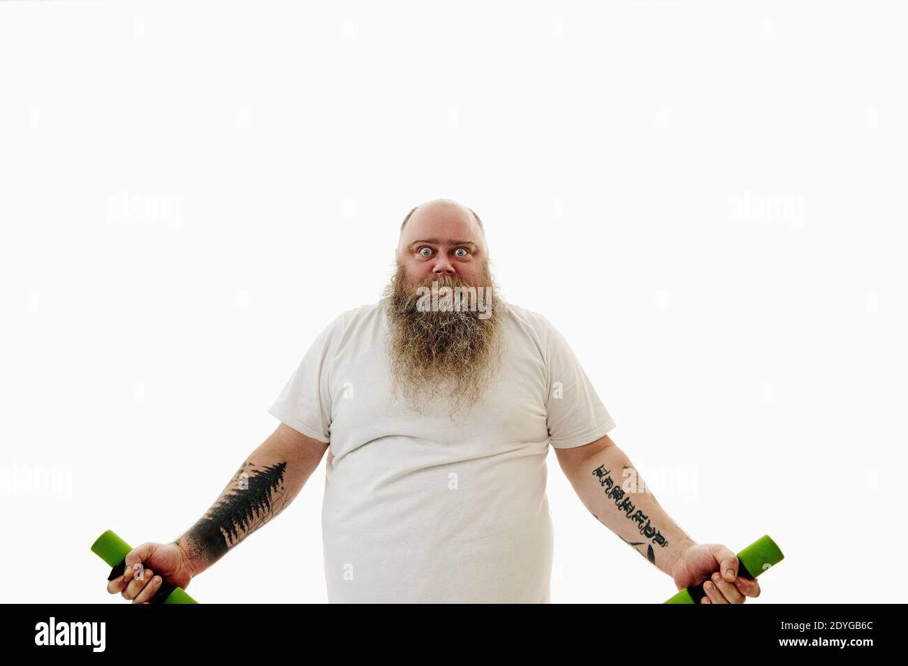 Syndrome bodybuilding hi-res stock photography and images - Alamy