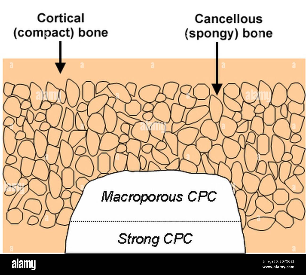 Layered Approach May Yield Stronger More Successful Bone Implants ...