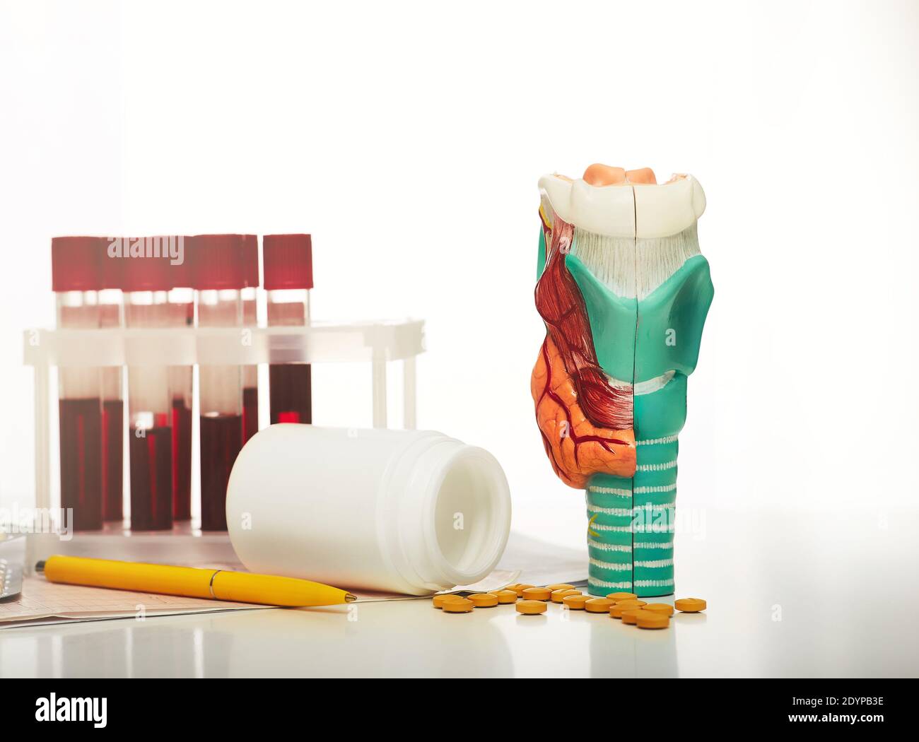 Thyroid disease diagnostic and treatment concept. Anatomical model of ...