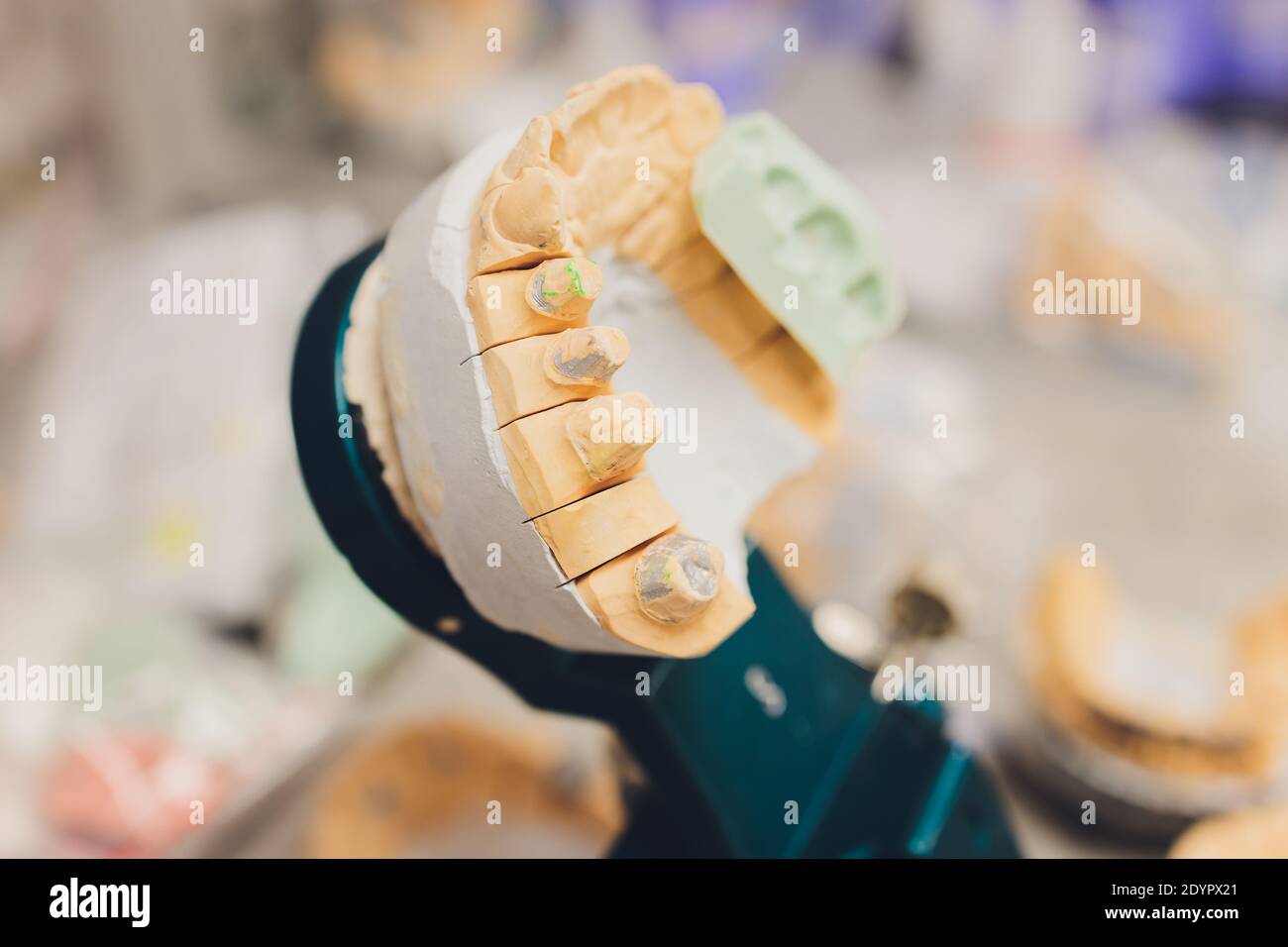 The process of making a dental prosthesis in a dental laboratory Stock ...