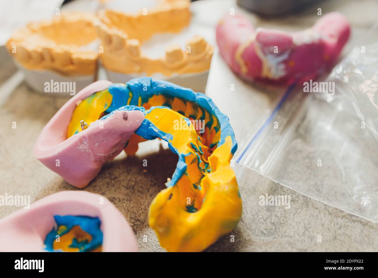 The process of making a dental prosthesis in a dental laboratory Stock ...