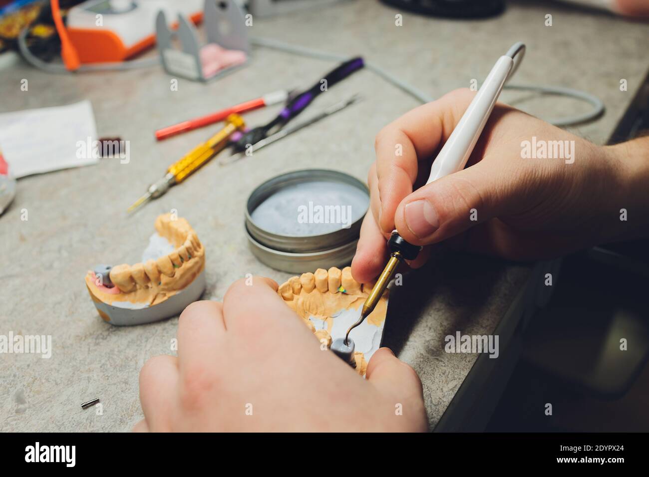 The process of making a dental prosthesis in a dental laboratory Stock ...