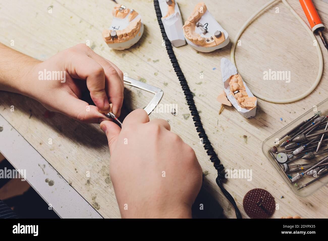 The process of making a dental prosthesis in a dental laboratory Stock ...