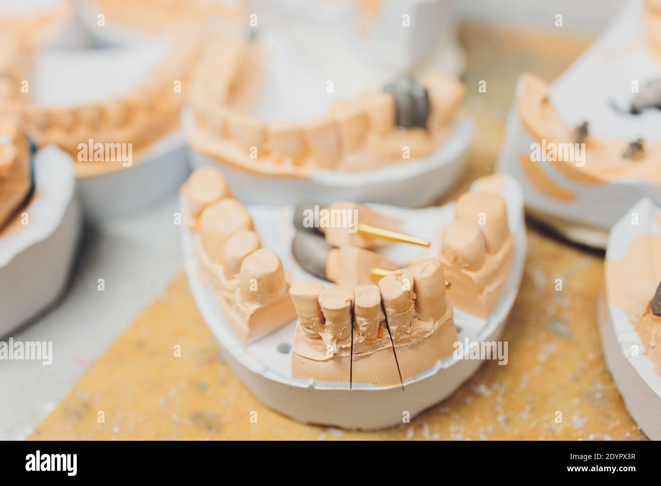 The process of making a dental prosthesis in a dental laboratory Stock ...