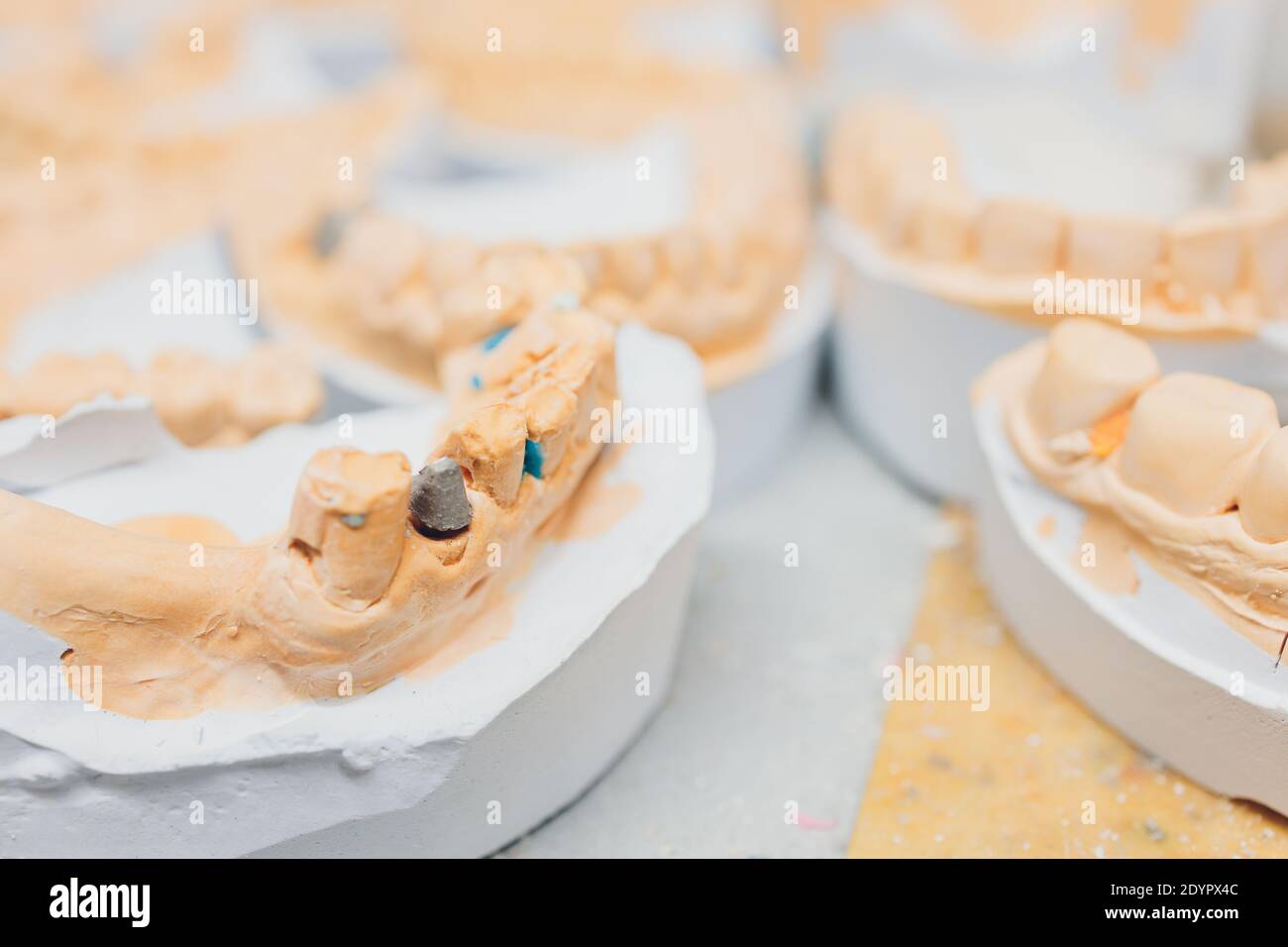 The process of making a dental prosthesis in a dental laboratory Stock ...