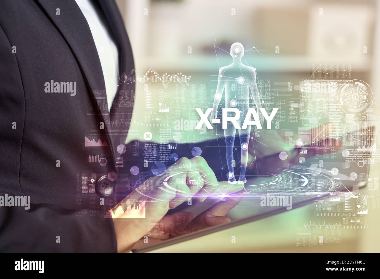 Electronic medical record with X-RAY inscription, Medical technology ...