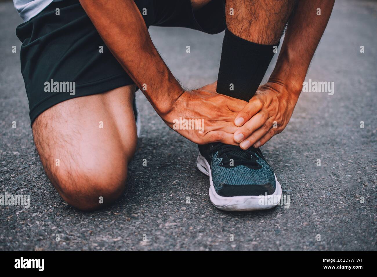 Ankle osteoarthritis hi-res stock photography and images - Alamy