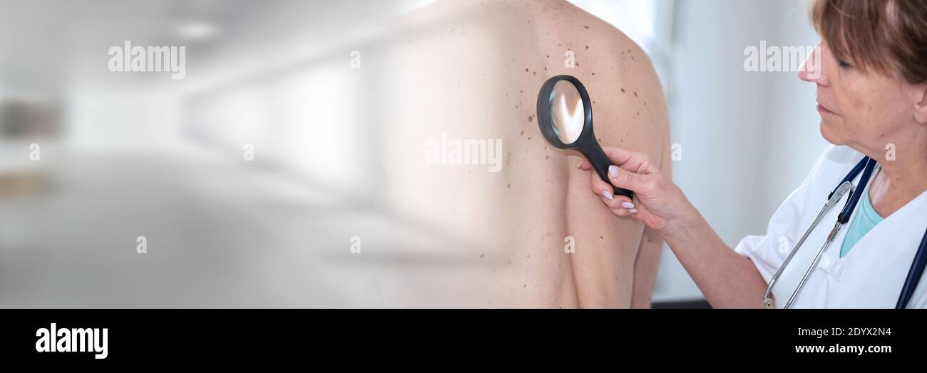 Dermatologist examining the skin on the back of a patient; panoramic ...