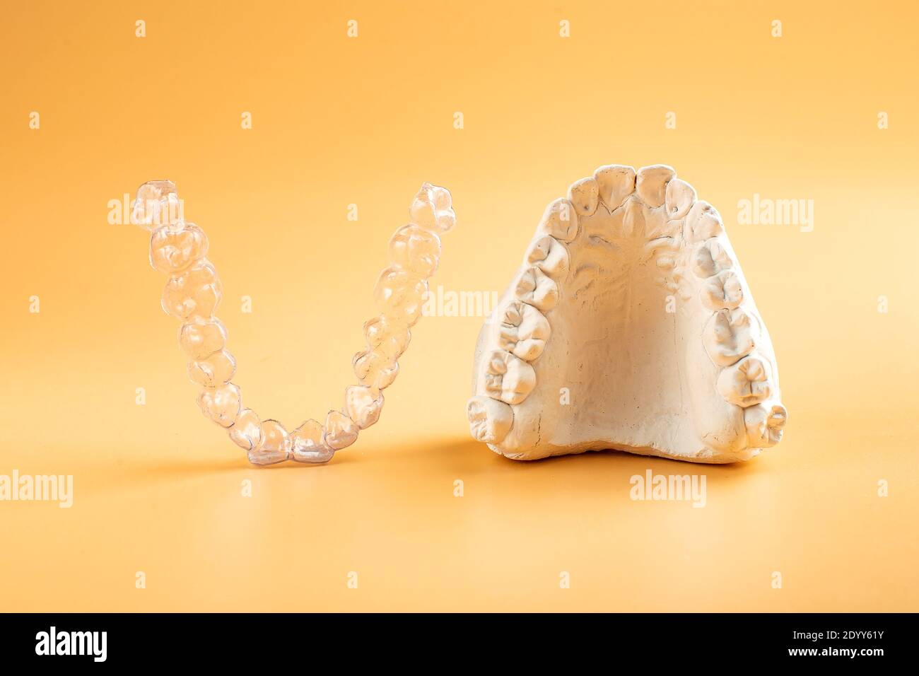Close-up individual tooth tray Orthodontic dental theme. In hand ...