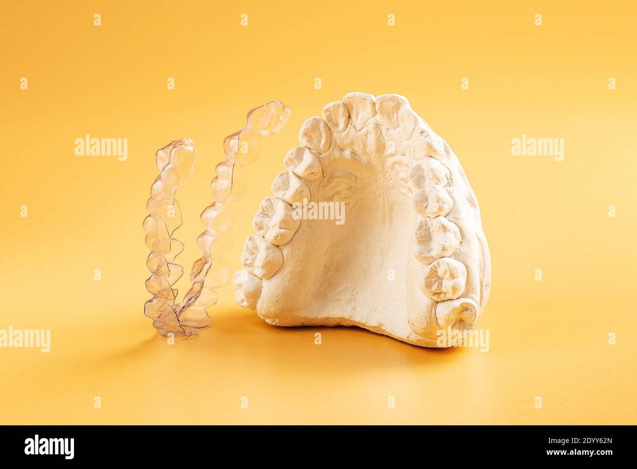 Close-up individual tooth tray Orthodontic dental theme. In hand ...