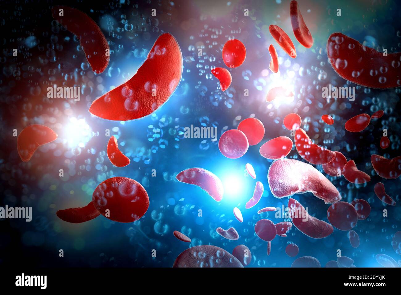 Sickle cell anemia disease (SCD) blood cells 3D illustration Stock ...