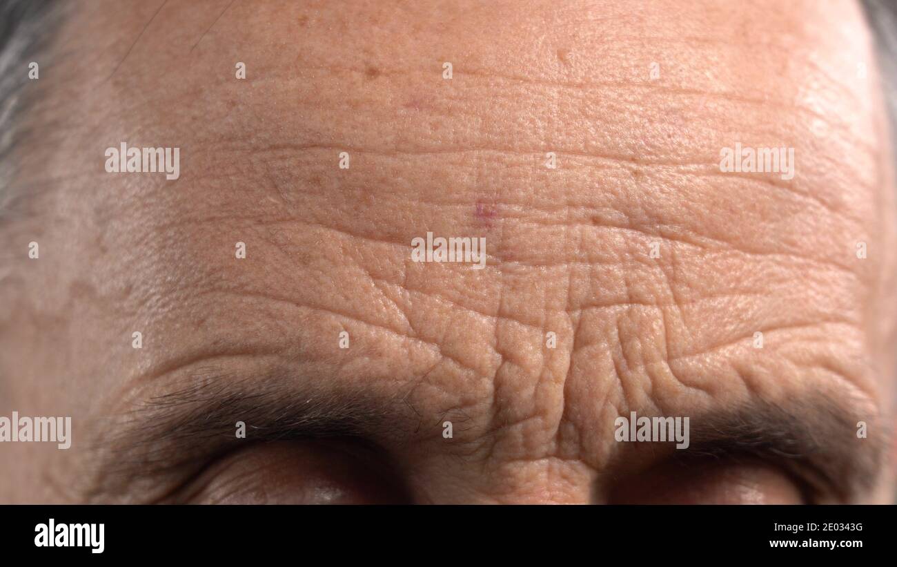Wrinkled Male Forehead Close Up. Mature Man's Forehead and Wrinkles ...