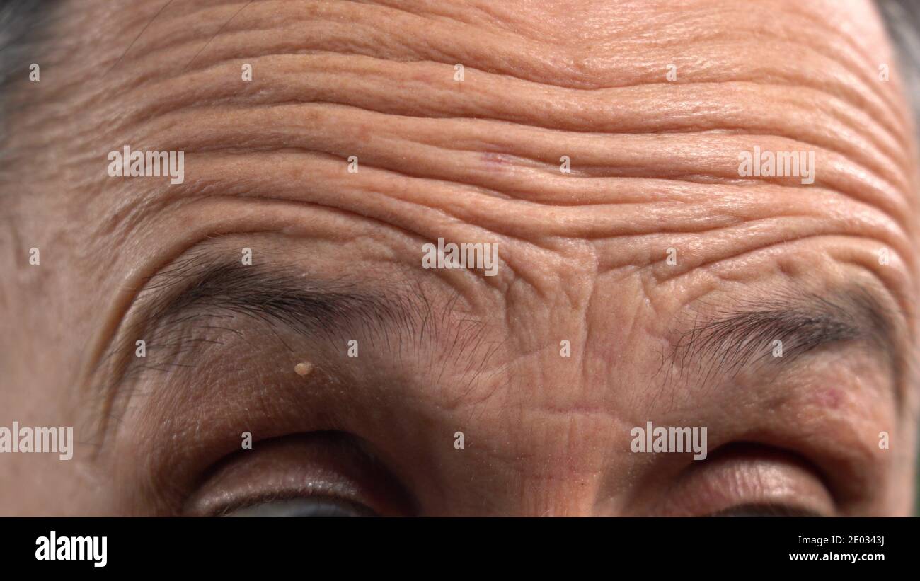 Forehead folds hi-res stock photography and images - Alamy