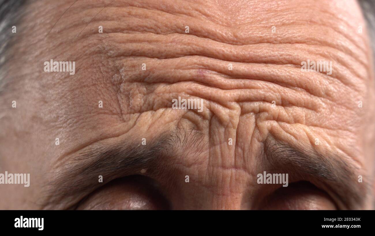 Wrinkled Male Forehead Close Up. Mature Man's Forehead and Wrinkles ...