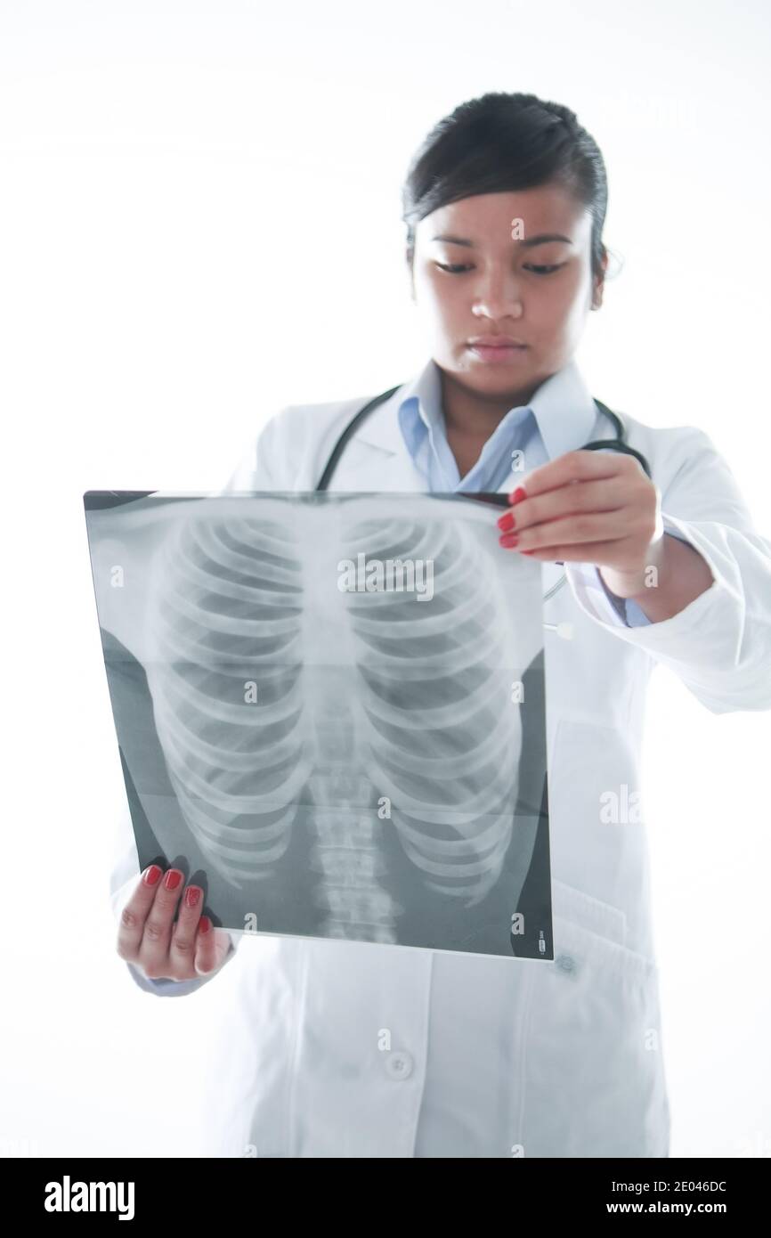 A doctor checking up an x ray of a patient Stock Photo - Alamy