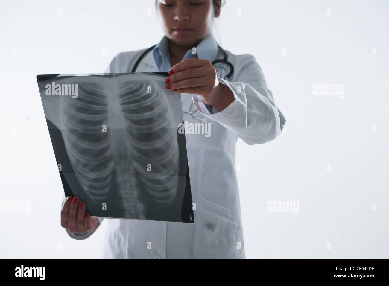 A doctor checking up an x ray of a patient Stock Photo - Alamy