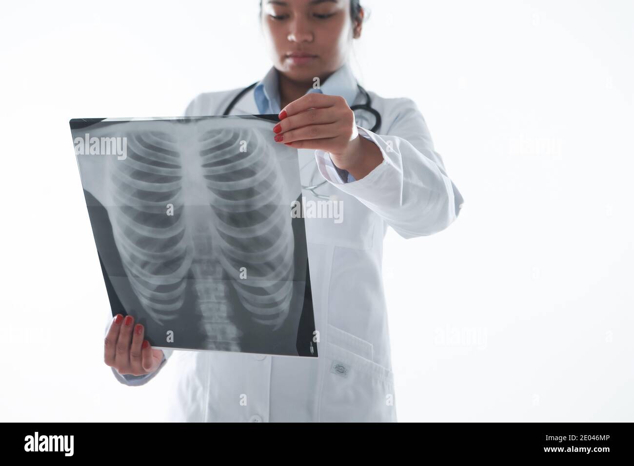 A doctor checking up an x ray of a patient Stock Photo - Alamy
