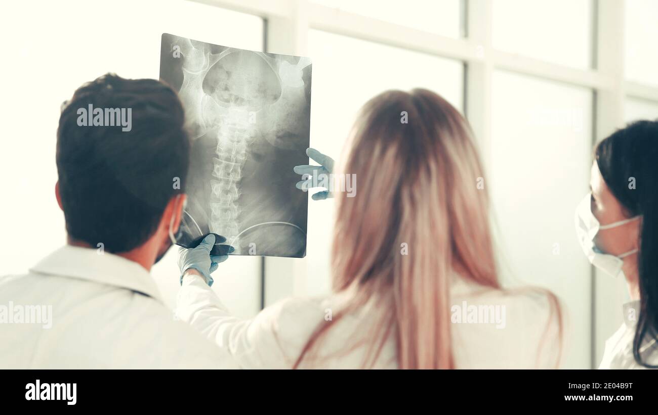 rear view. a group of surgeons discussing x-ray Stock Photo - Alamy