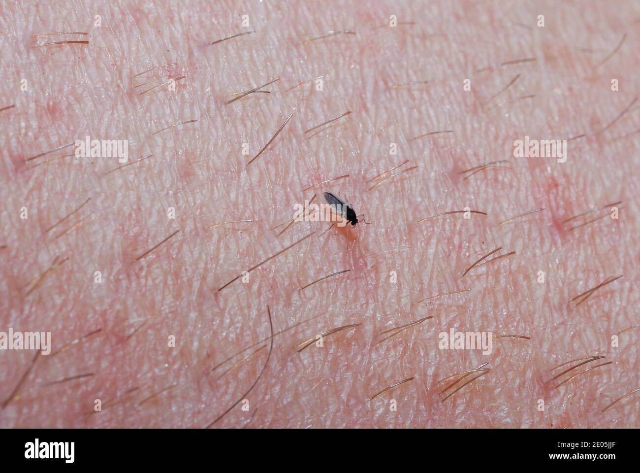 small insect with wings sitting on a human skin with hair Stock Photo ...