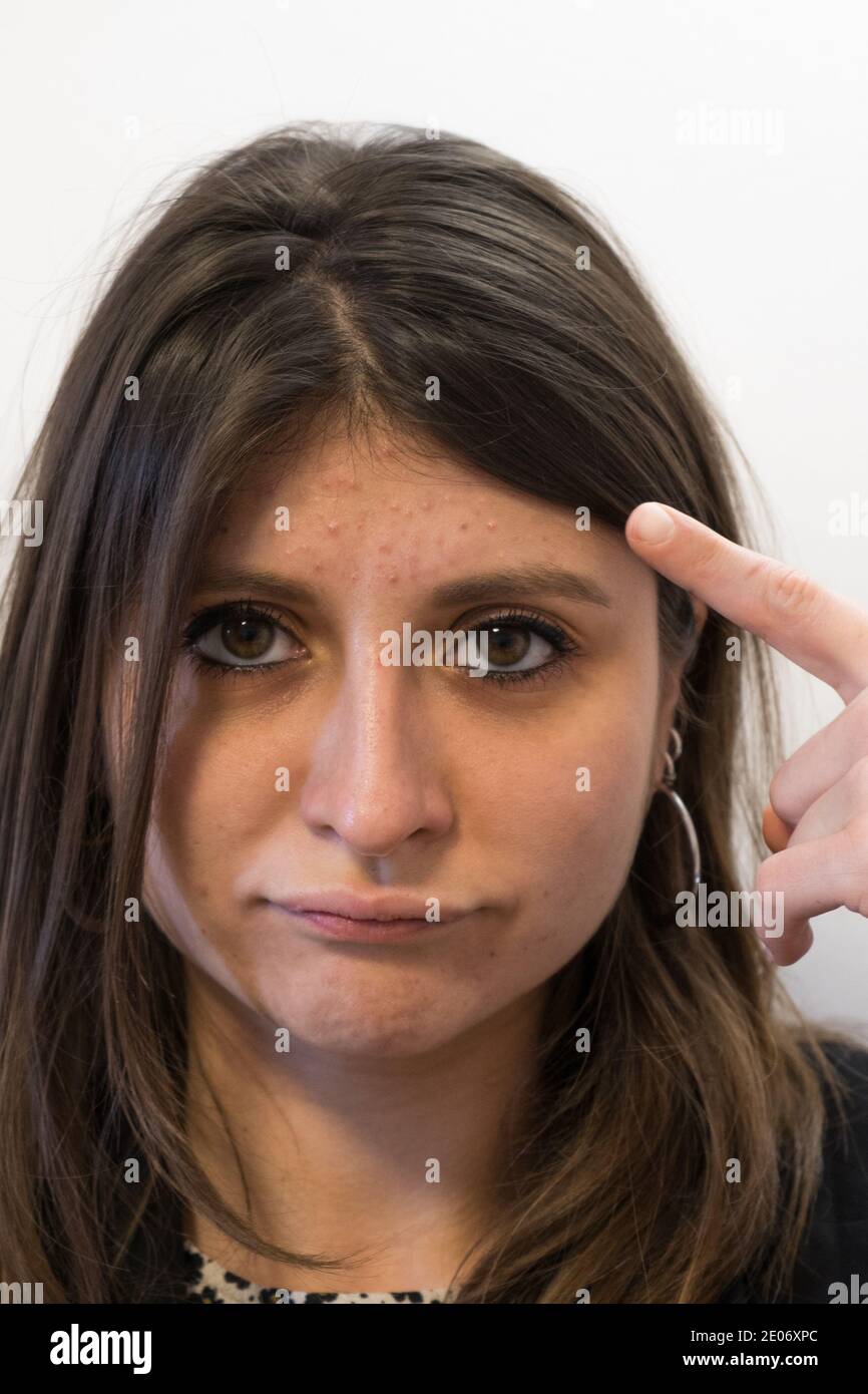 An isolated portrait of young woman having problem skin and pimple on ...