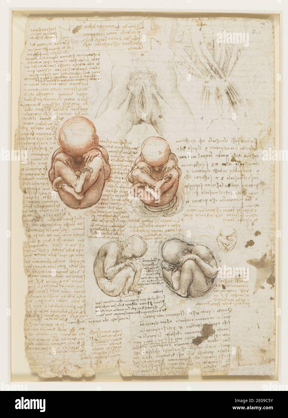 Leonardo da Vinci - Recto The fetus, and the muscles attached to the ...