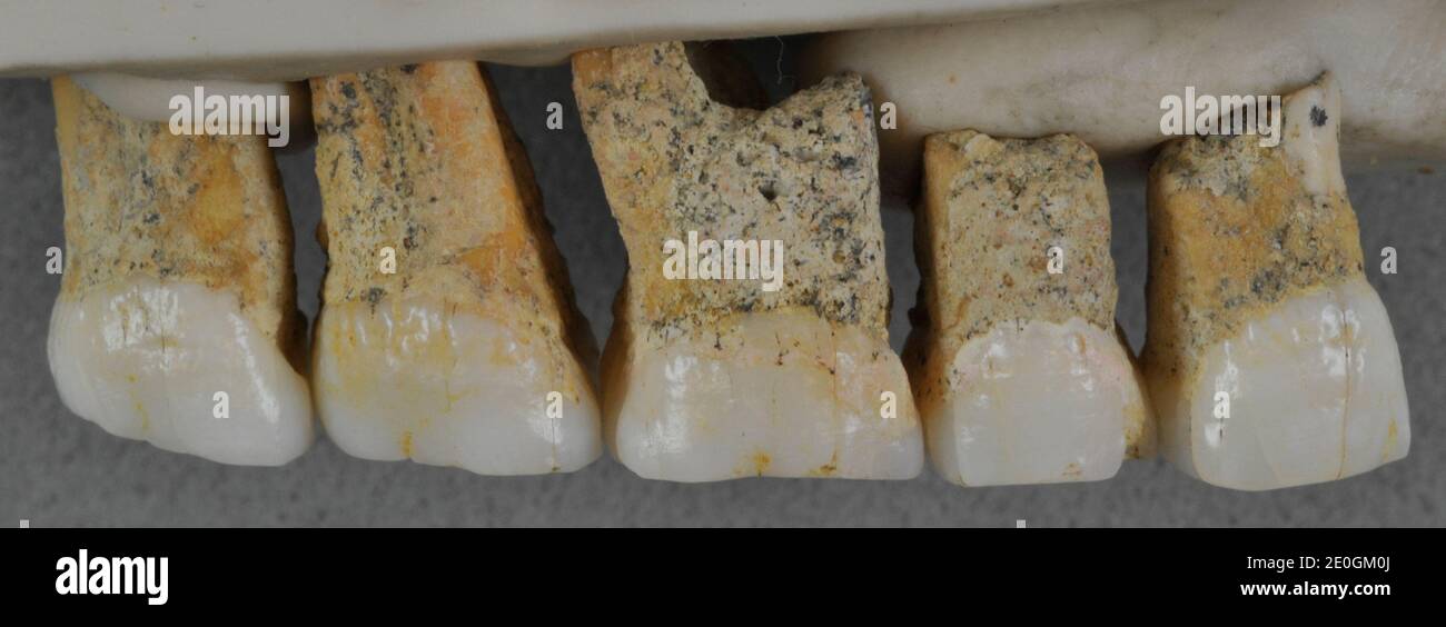 The right upper teeth of the individual CCH6 of the newly discovered ...