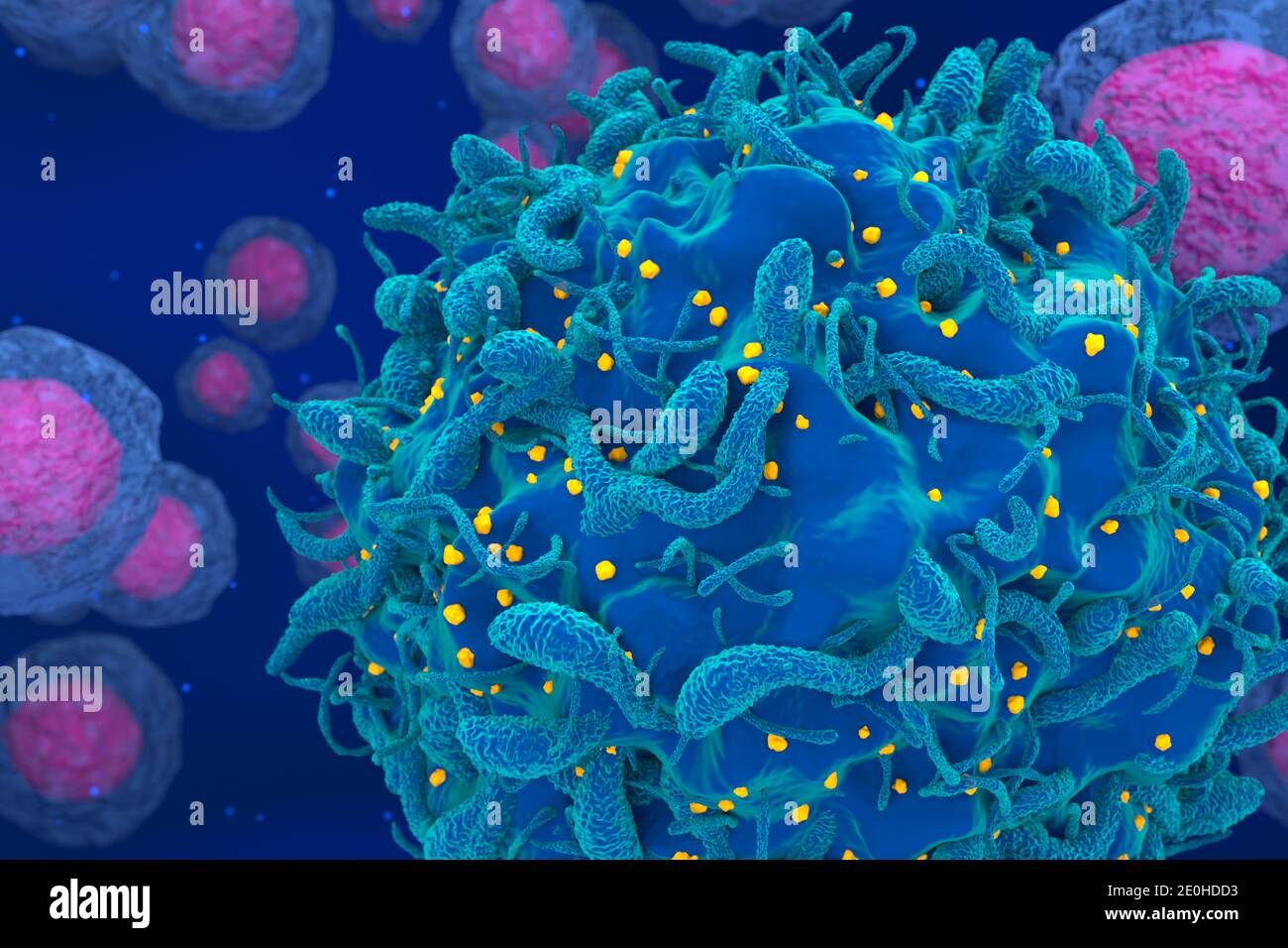 Hiv virus attack and infected t-cell with regular cells closeup 3d ...