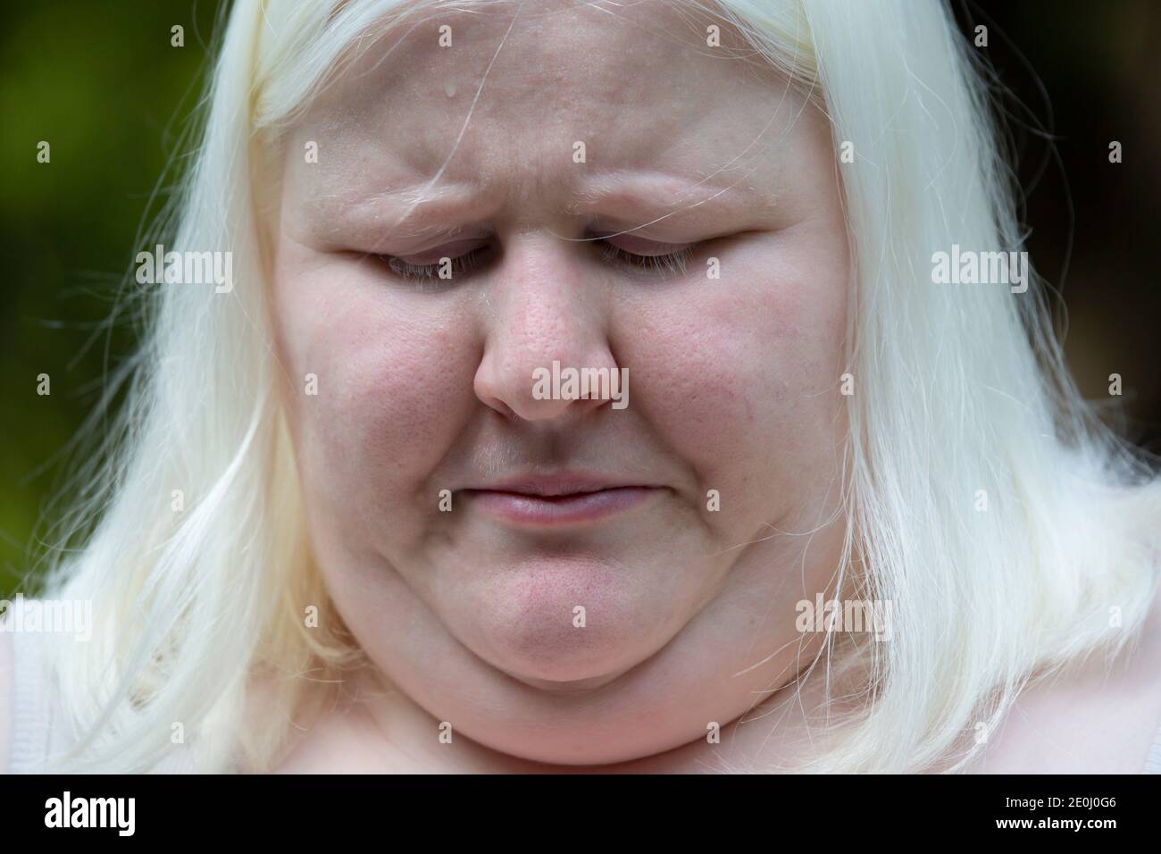 Albino human eye hi-res stock photography and images - Alamy