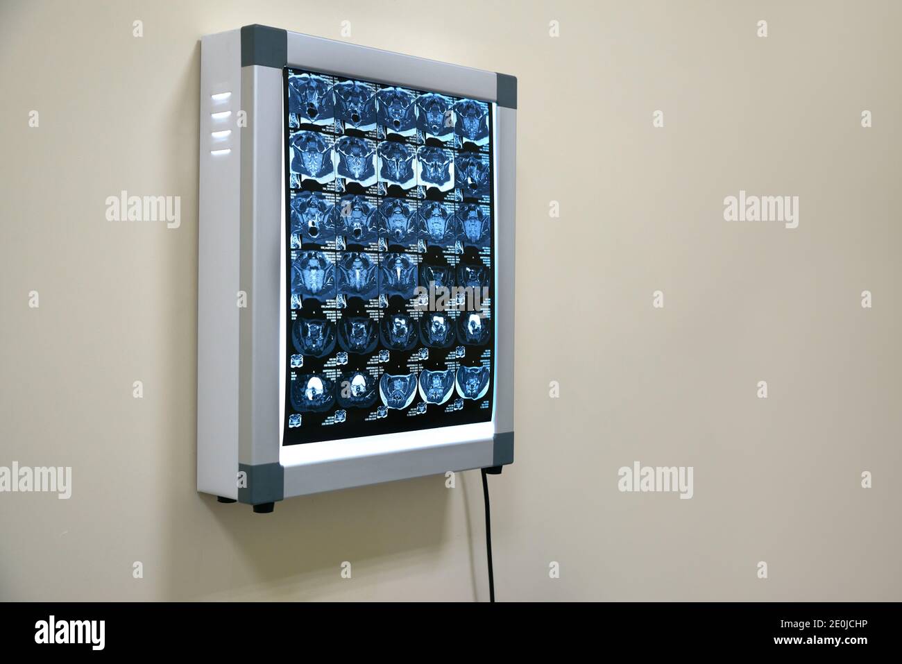Modern computer device in a hospital room showing mri results Stock ...