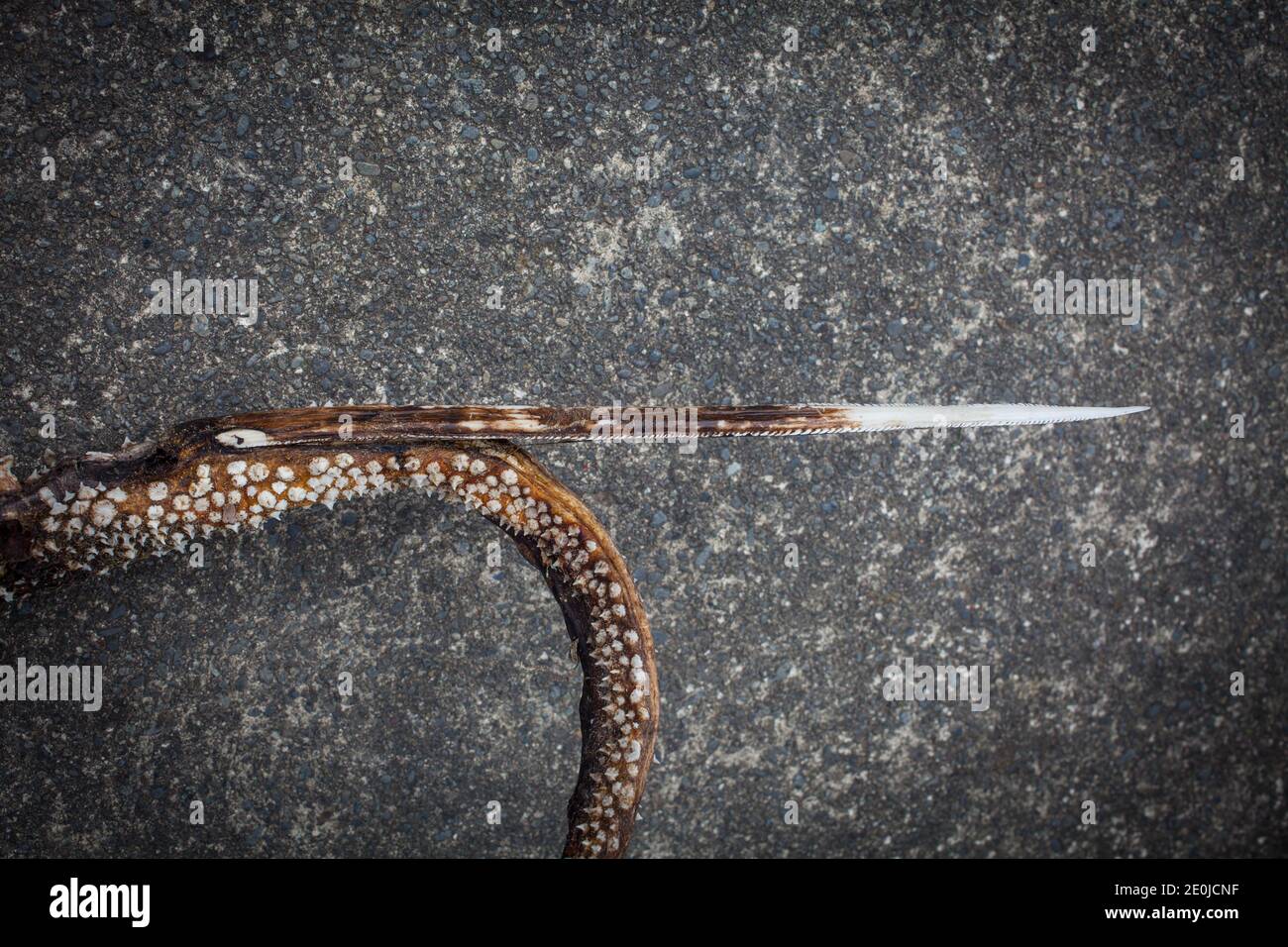 Stingray Stinger Removal