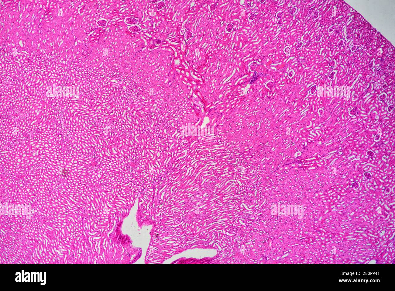 Renal medulla hi-res stock photography and images - Alamy