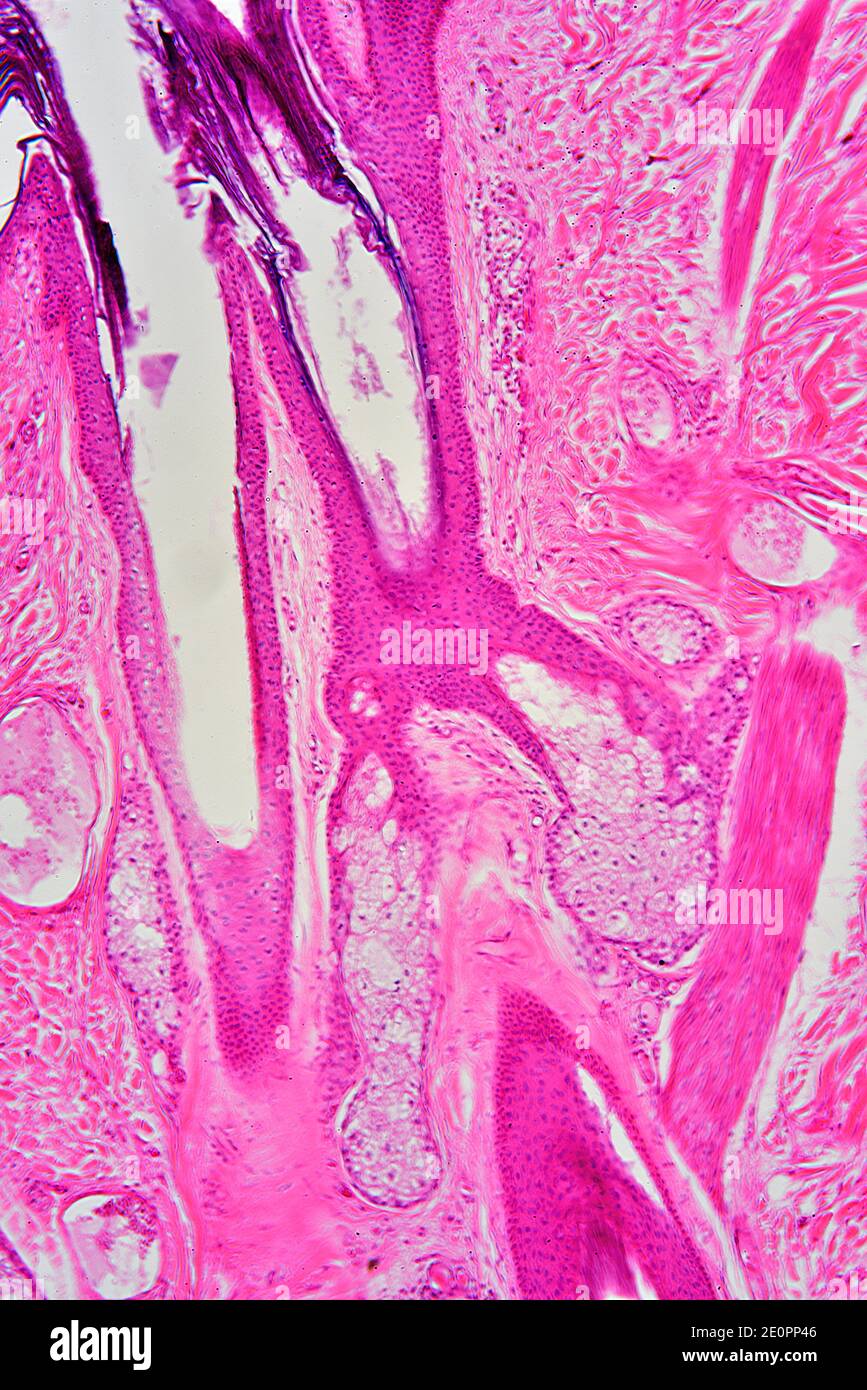 Sebaceous gland hi-res stock photography and images - Alamy