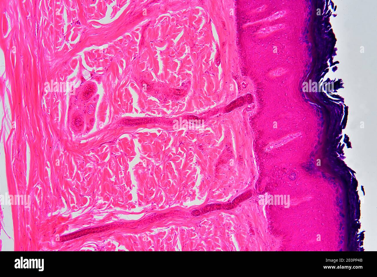 Sweat glands microscope hi-res stock photography and images - Alamy