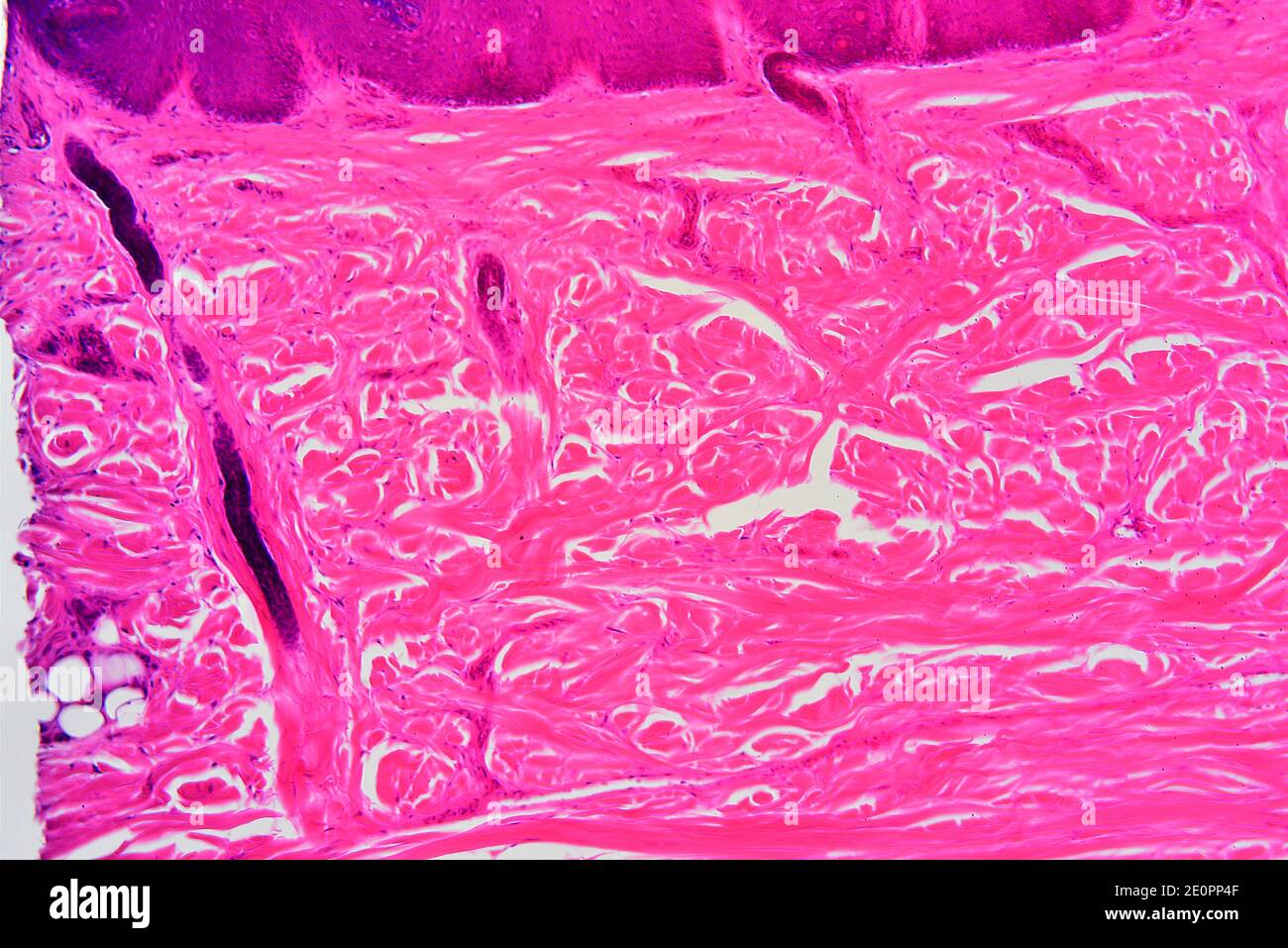 Skin glands hi-res stock photography and images - Alamy