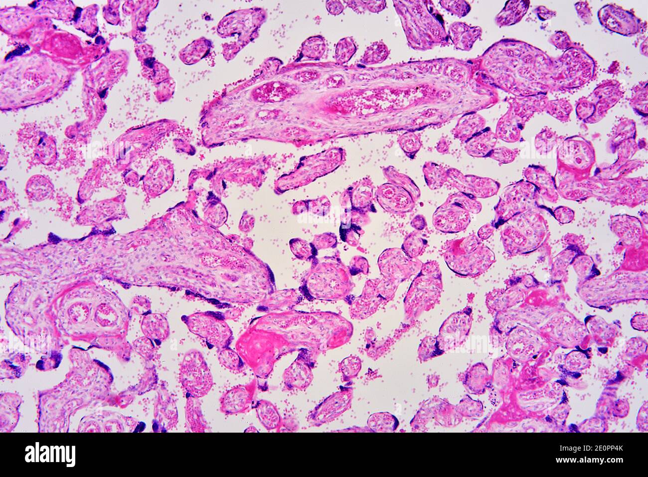 Microscope Blood Cells High Resolution Stock Photography and Images - Alamy