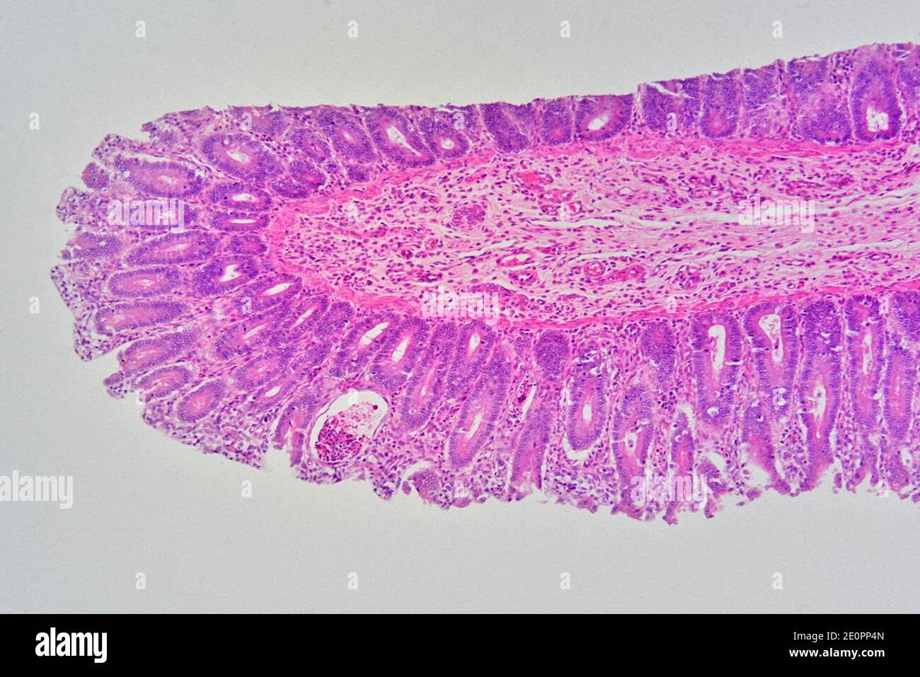Large intestine mucosa and submucosa hi-res stock photography and ...