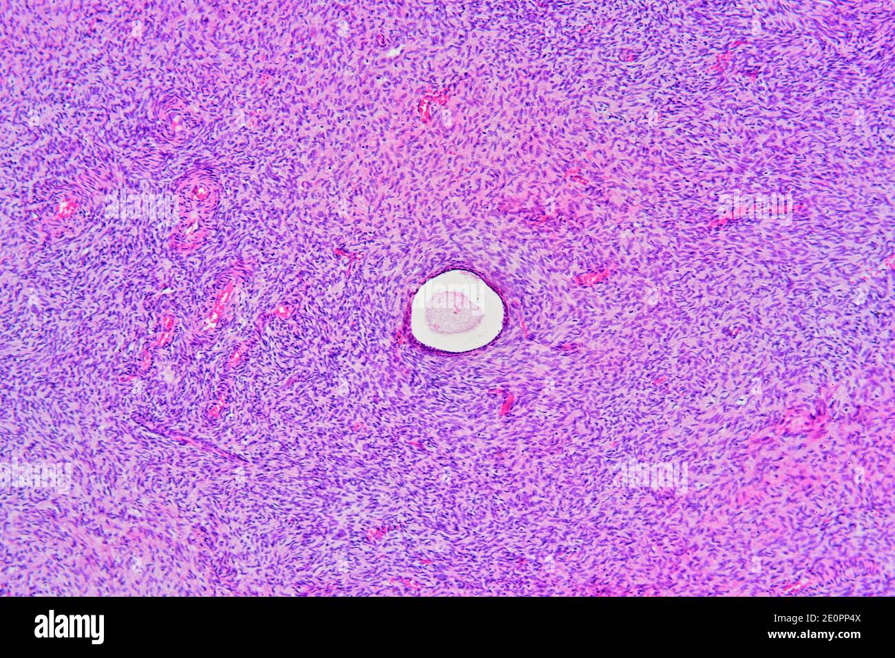 Histology human reproductive system hi-res stock photography and images ...