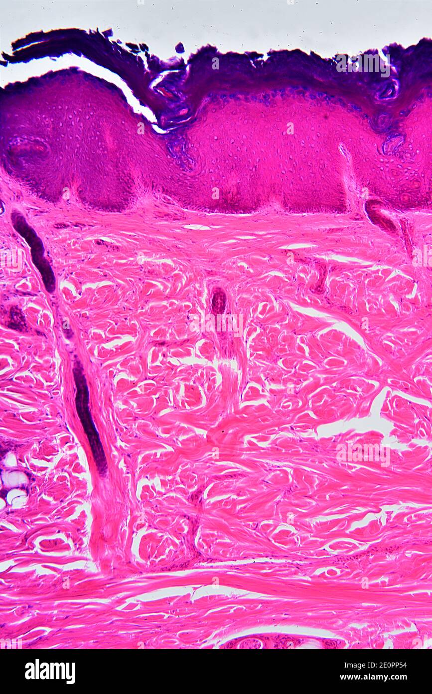 Sweat glands microscope hi-res stock photography and images - Alamy