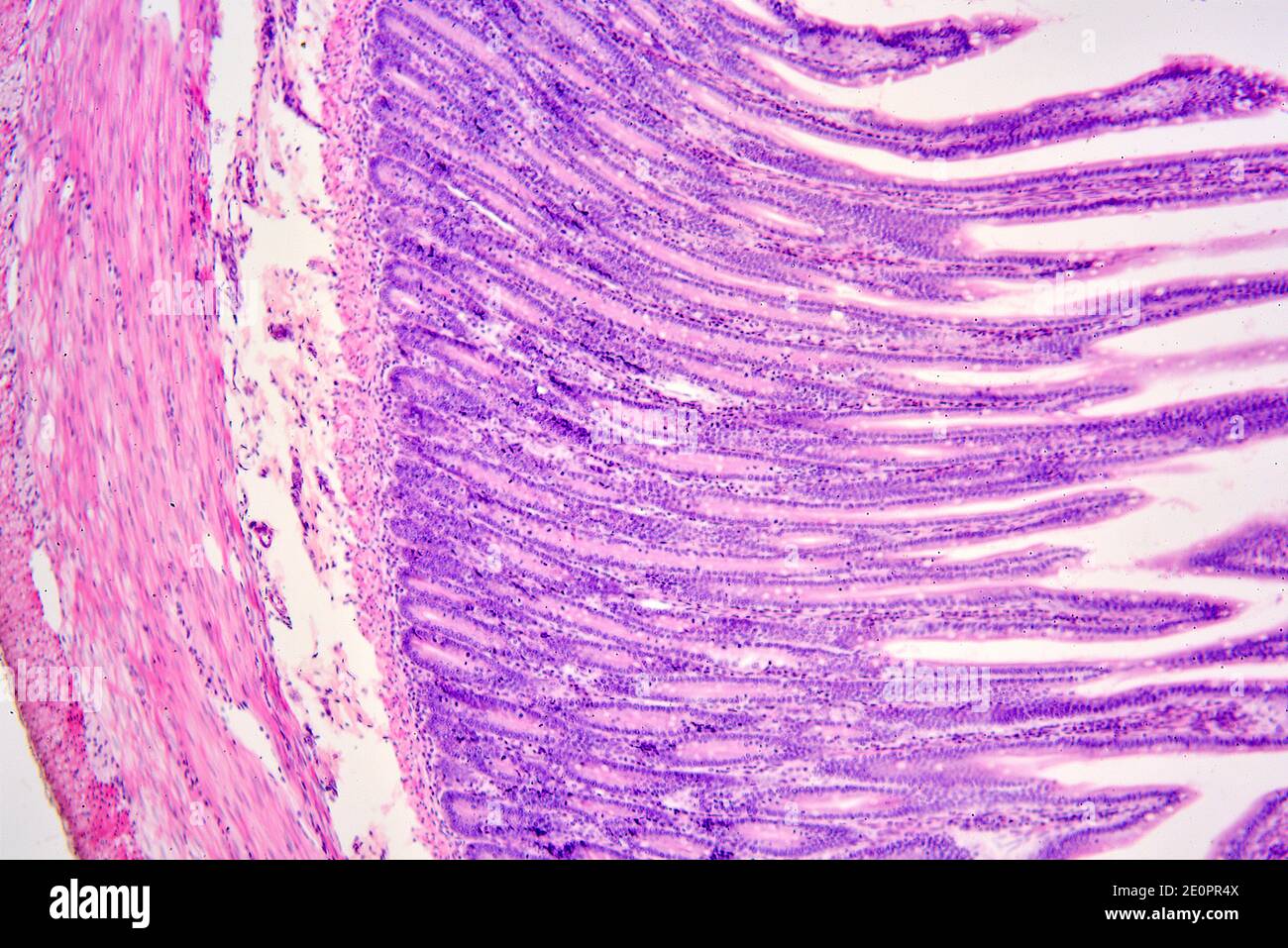 Human Duodenum Histology