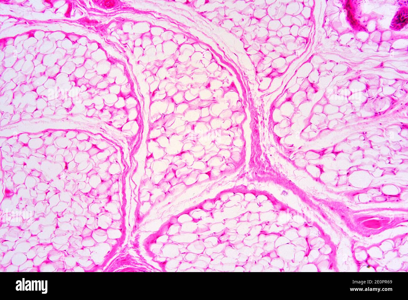 Adipose tissue hi-res stock photography and images - Alamy