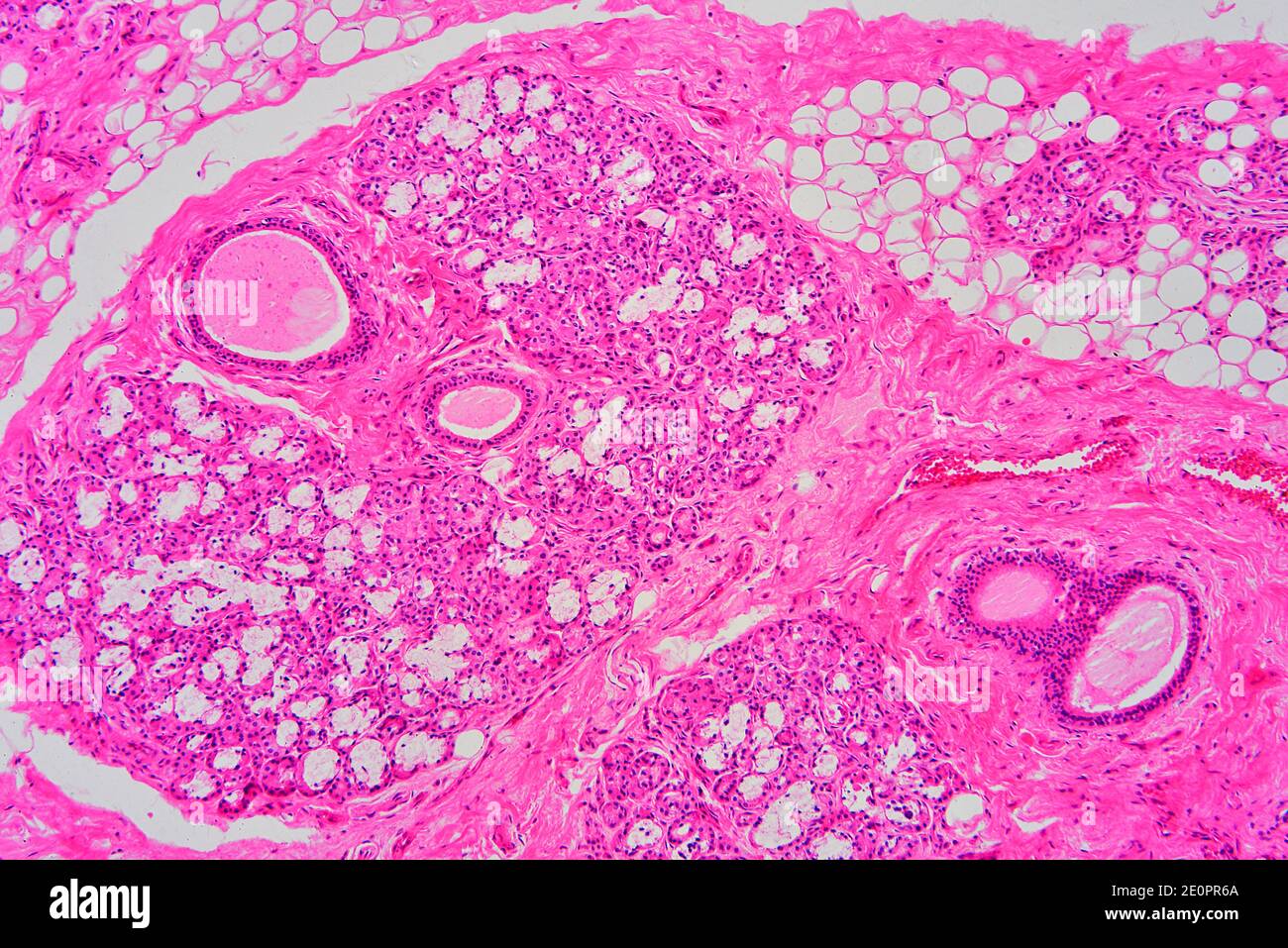 Human umbilical cord hi-res stock photography and images - Alamy