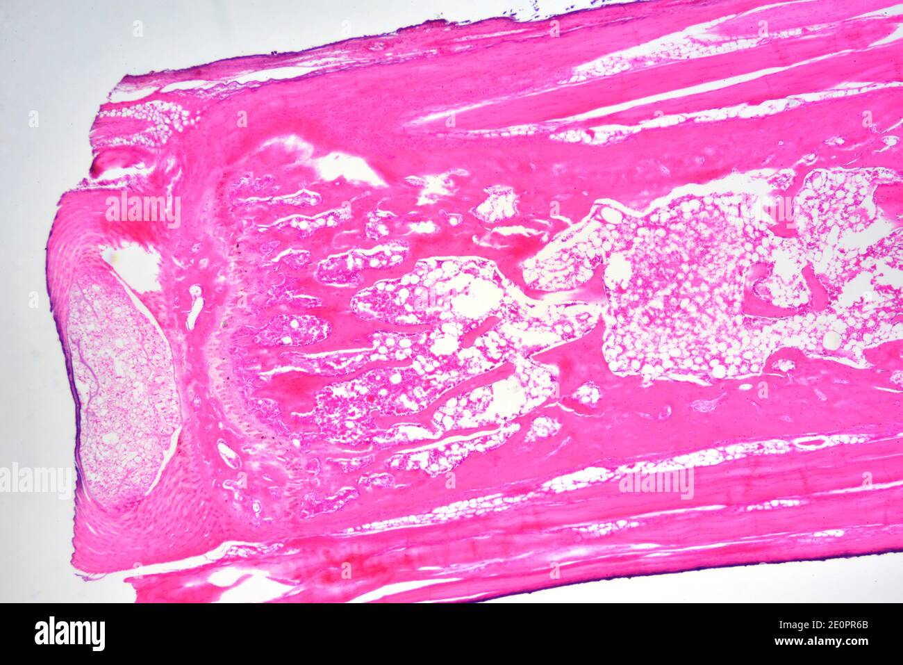 Muscle-tendon conection in a long bone. X25 at 10 cm wide Stock Photo ...