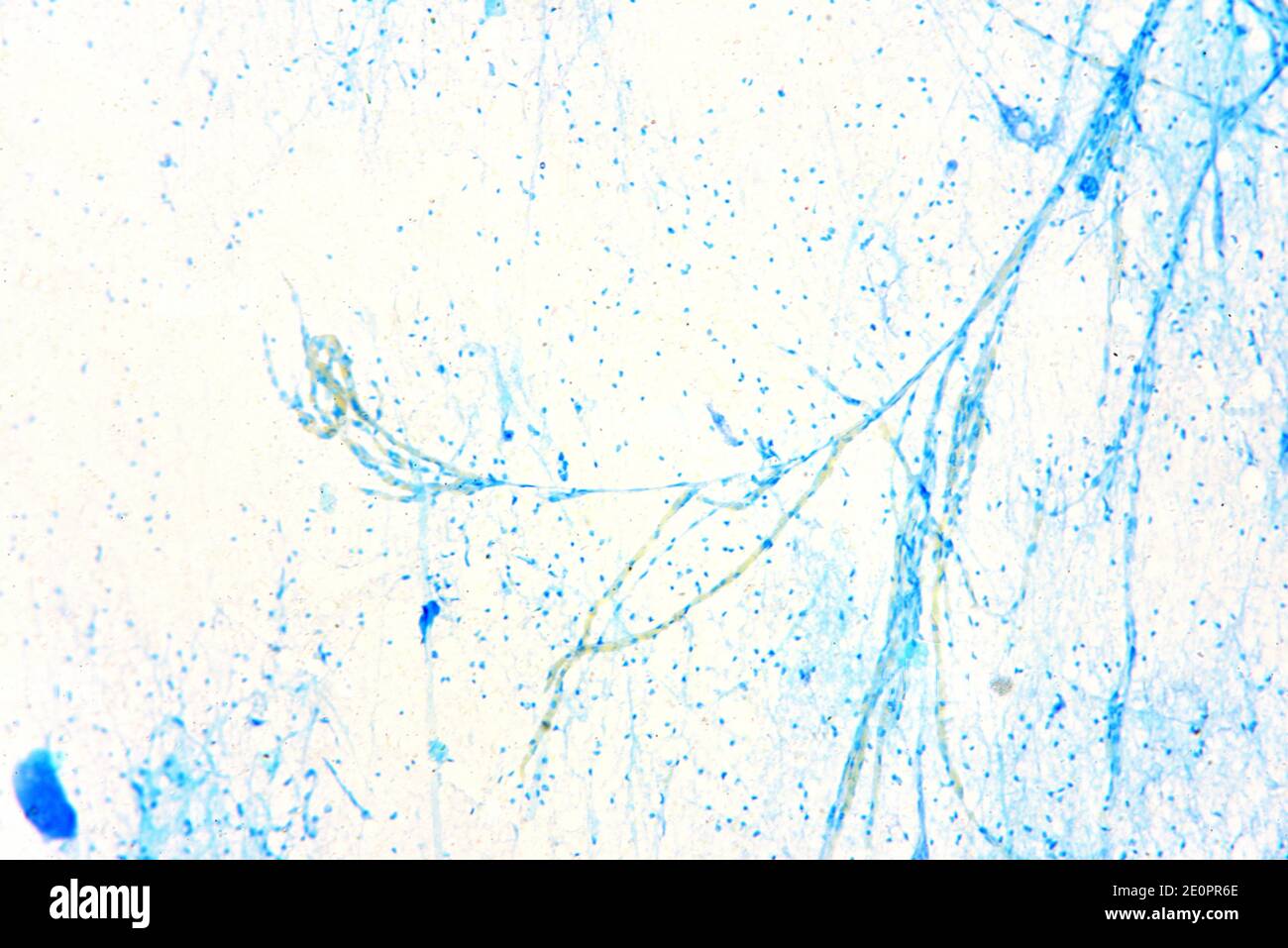 Human neuron micrograph hi-res stock photography and images - Alamy
