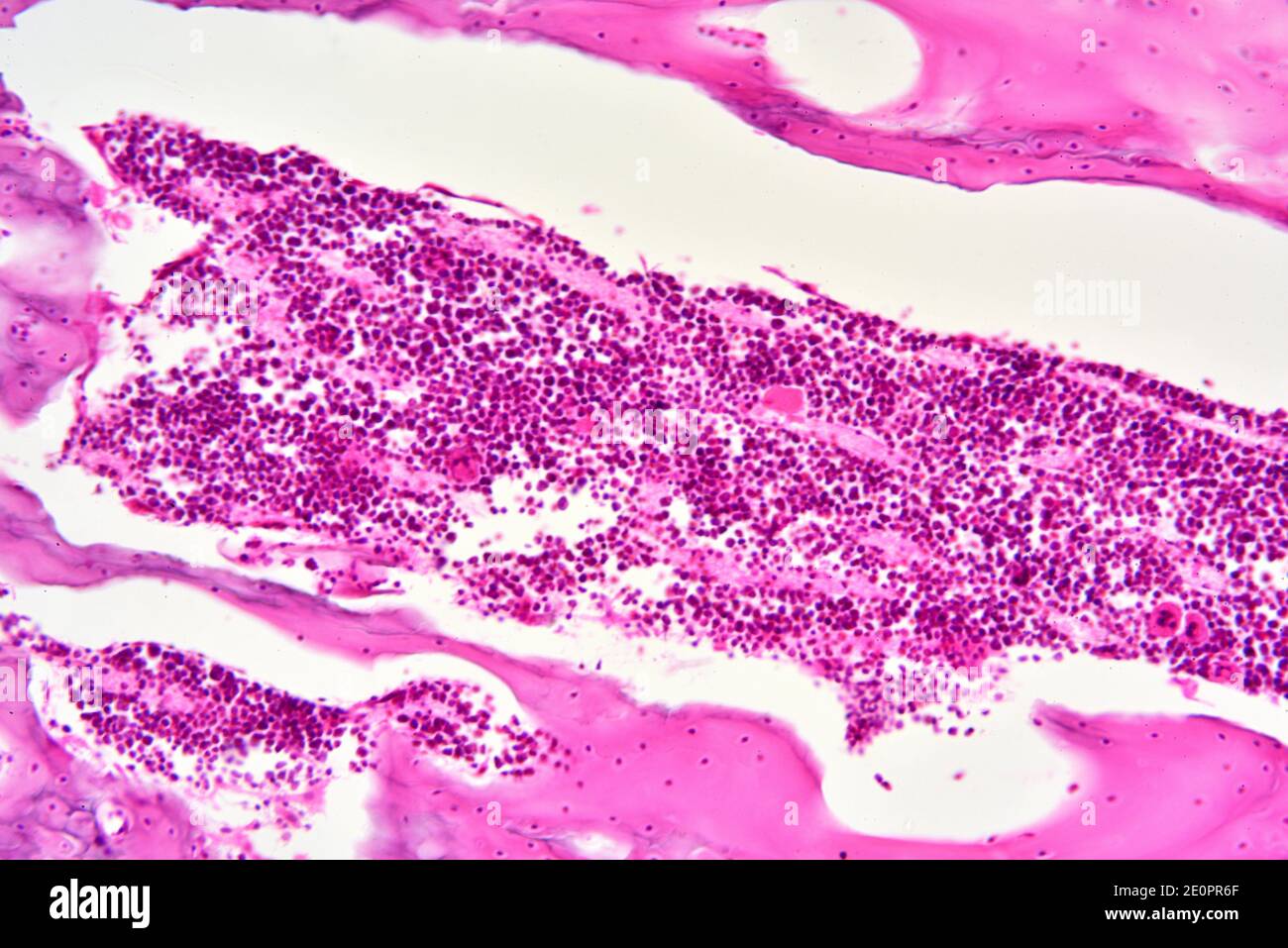 Megakaryocyte Histology