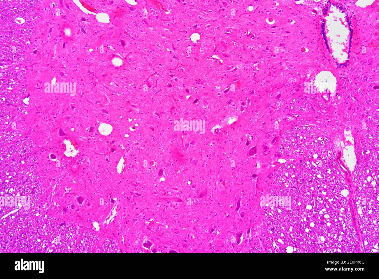 Histology spinal cord hi-res stock photography and images - Alamy