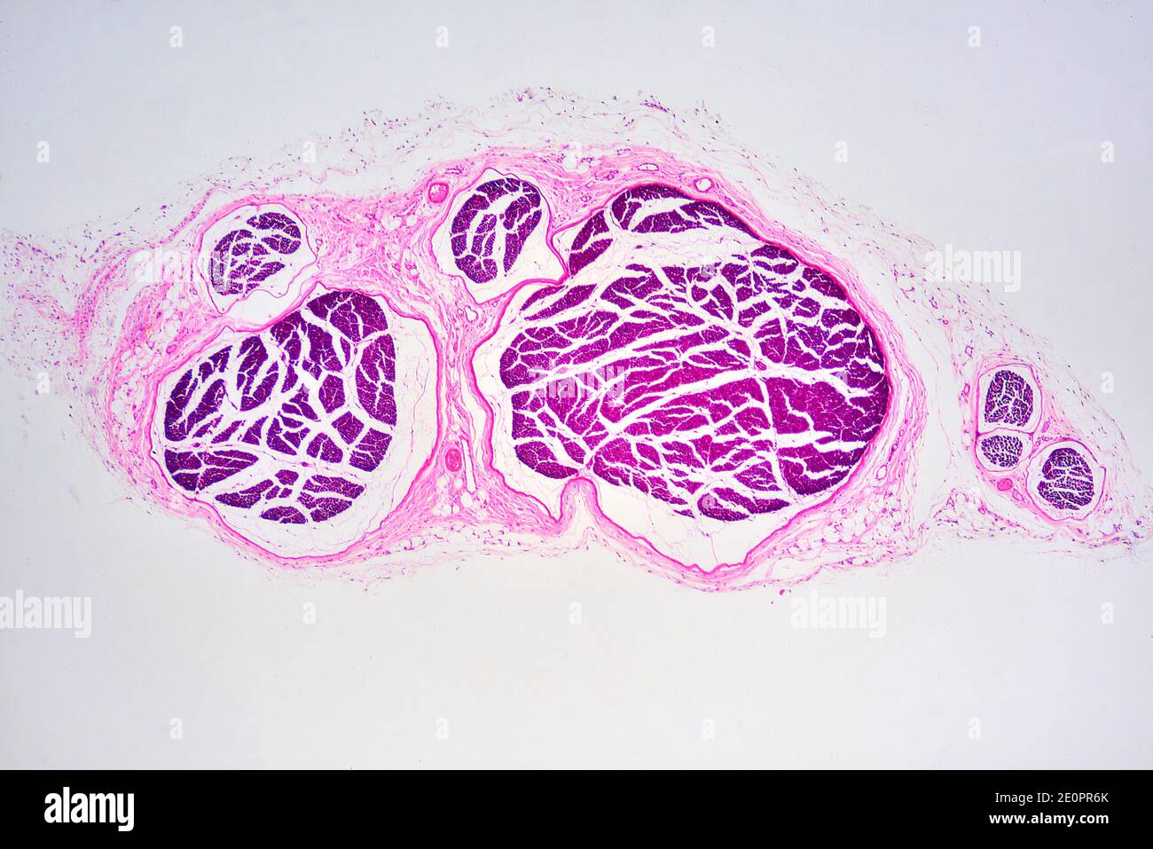 Epineurium hi-res stock photography and images - Alamy