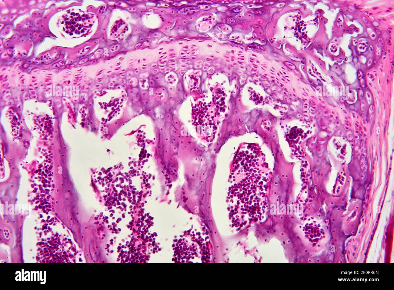 Photomicrograph Of Bone Marrow Tissue High Resolution Stock Photography ...