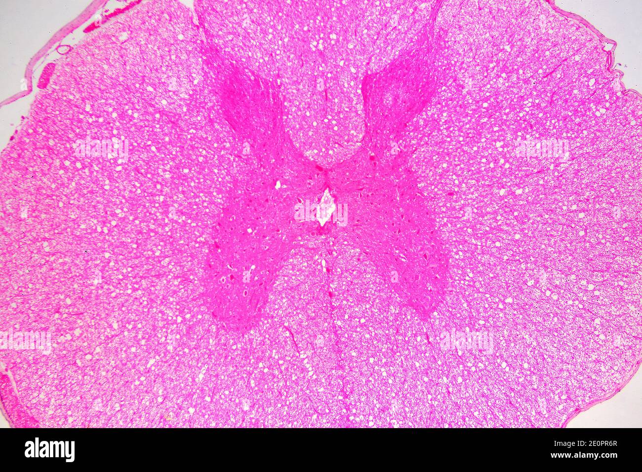 Spinal Cord Meninges Histology